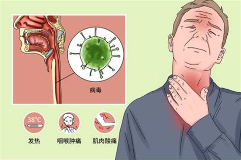 疱疹性食管炎有什么症状如何诊断厦门高尚健康体检