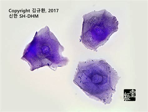 열에 의해 손상된 입 안 상피세포 현미경 관찰 네이버 블로그