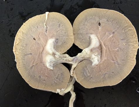 Lab Exercise 40 Figure 3a Diagram Quizlet