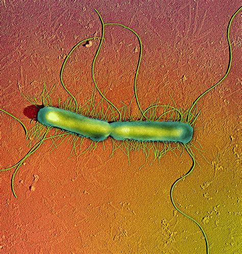 Coloracao De Capsula De Proteus Vulgaris Untitled