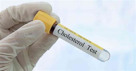 Escándalo Sobre Los Efectos Secundarios Desastrosos De Las Estatinas