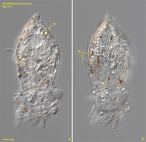 Cylindrifflugia Bacillariarum Real Micro Life