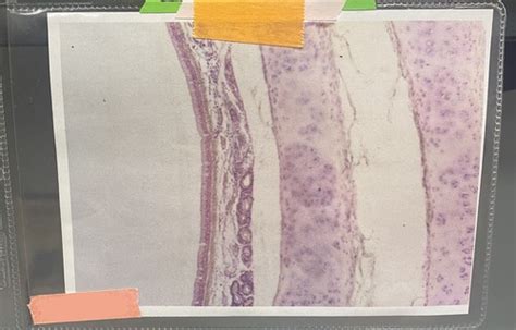 Practical 3 Microphotographs Flashcards Quizlet