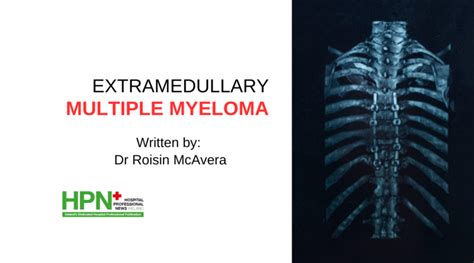 Extramedullary Multiple Myeloma Hospital Professional News