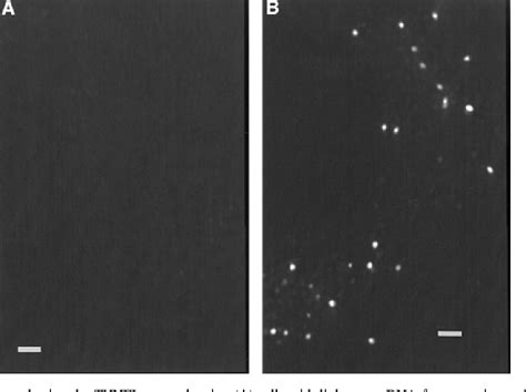 Figure From Differences In Nuclear DNA Fragmentation And Mitochondrial Integrity Of Semen And