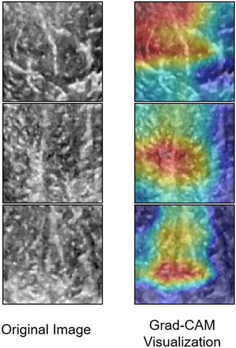 example of dcnn model image input and grad cam visualization of