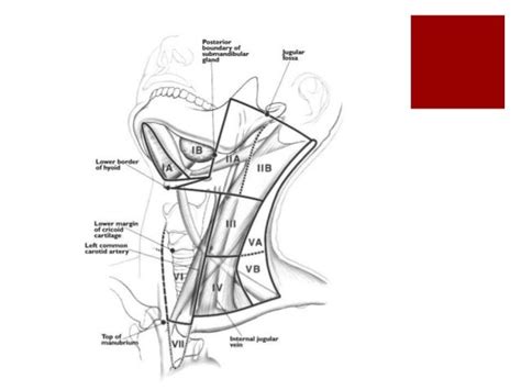 Anterior Cervical Lymph Nodes