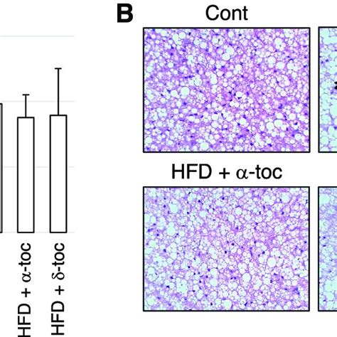 Effects Of α Tocopherol And δ Tocopherol On Histology Of Mice Brown