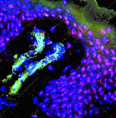 Skin Fluorescent Light Micrograph Stock Image C021 0929 Science Photo Library