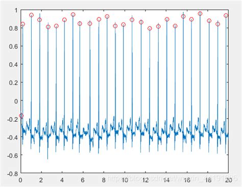Matlab中wfdb库安装并使用waveform Database Wfdb Matlab Csdn博客