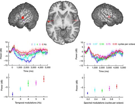Intracranial Ecog Recordings In A Patient With Bilateral Stereotactic Download Scientific
