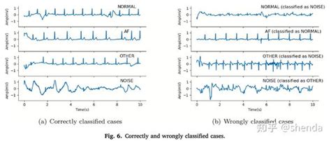Bspc 2022 构建ecg心电信号分类的深度snn脉冲神经网络 知乎