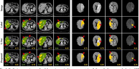 Figure 4 From Mumford Shah Loss Functional For Image Segmentation With Deep Learning Semantic
