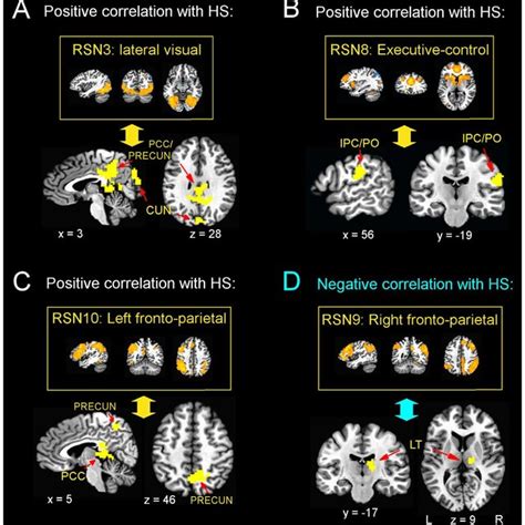 Inter Individual Differences In Resting State Functional Connectivity
