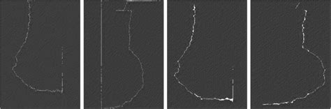 Edges Of Various Mammograms Taken By Edge Detector Prewitt Download Scientific Diagram