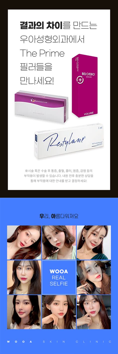 레스틸렌 프리미엄 필러 우아성형외과의원