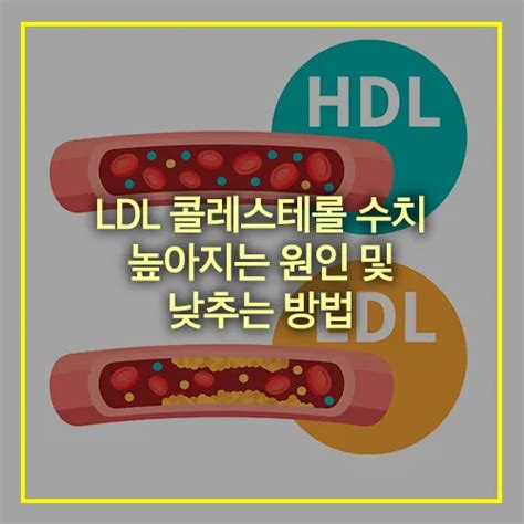 Ldl 콜레스테롤 수치 높아지는 원인 및 낮추는 방법 써니의 건강과 꿀팁