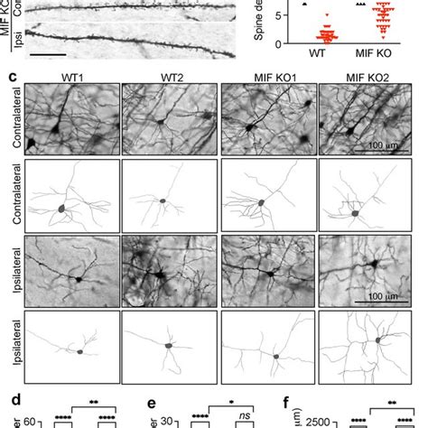 Characterization Of Dendritic Spine Density And Neuronal Morphology In Download Scientific