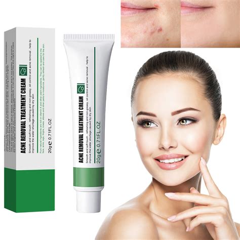 Jungdeepe Acne Scar Removal Anti Moisturizing Anti Effective Remove Melasma Melanin Dark Spots