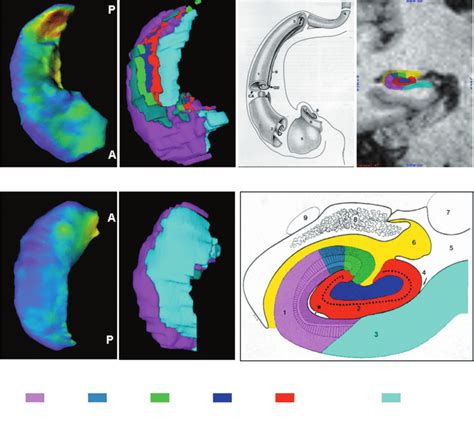 Hippocampus Subfields Atlas A And E Hippocampal Deformation Map For