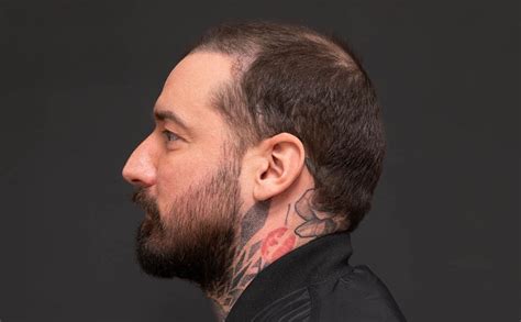 Haircuts For Balding Crown 21 Styles To Boost Your Confidence