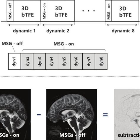 Schematic Overview Of The 3d Dynamic Improved Motion Sensitized Download Scientific Diagram
