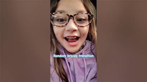 Silly Braces Transition Youtube
