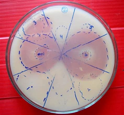 Liquid Phosphate Solubilizing Bacteria Packaging Type Bottle 1 Litre At ₹ 110 Litre In Surat