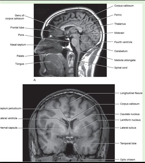Best 11 Imaging Of Pelvic Lymph Nodes Current Radiology Reports Artofit