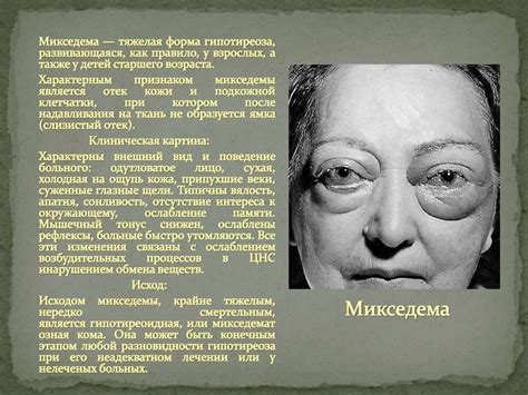 Болезни эндокринной системы презентация онлайн