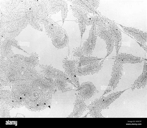 Historic Electron Microscope Photograph Of Functioning Genes Shown About 25 000 Times Actual