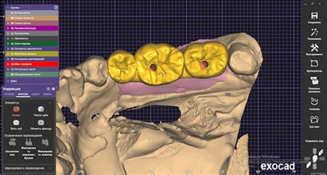 Design High Quality Veneers Crown Bridge Dental Restorations In Exocad By Dimaluki Fiverr