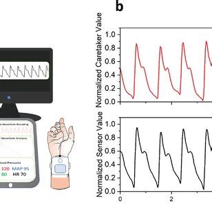 A Experiment Setup During Blood Pressure BP Measurement Using Both