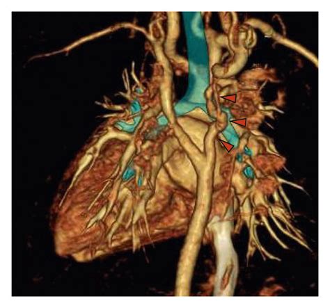 A B Contrast Enhanced Three Dimensional Computed Tomography Images