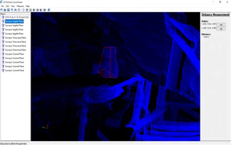 Uls Scan With Surveyor Anatomical Planes Torso Sagittal Transverse Download Scientific