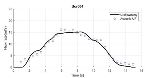 Ics 2020 Abstract 183 Comparing A Mobile Acoustic Uroflowmetry Device To Standard Uroflowmetry