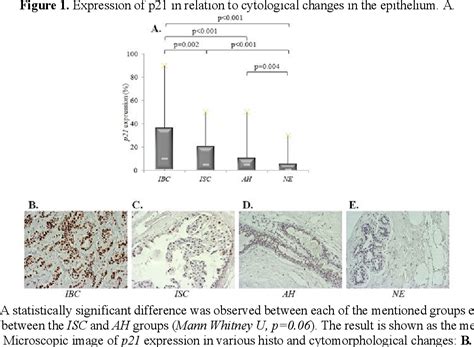 Figure 1 From Prognostic Significance Of P21 Protein In Breast Cancer