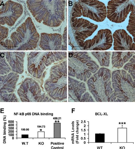 Up Regulation Of The Nf ␬ B Subunit P65 Rela In Untreated Colonic