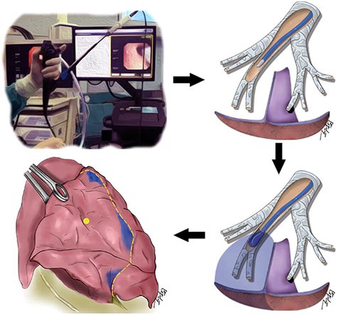 Thoracic Cancer Vol 14 No 24