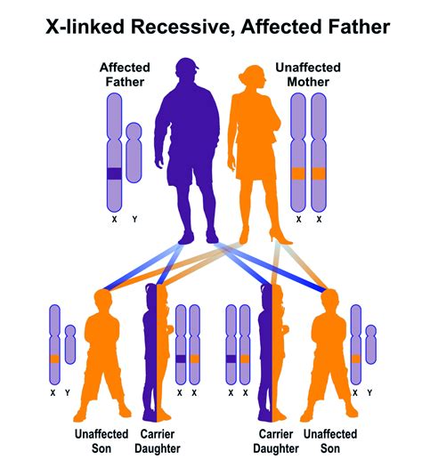 X Linked Recessive Father Affected Hereditary Ocular Diseases