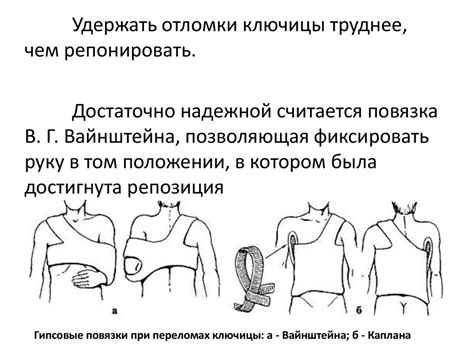 Симптомы перелома ключицы и способы его лечения