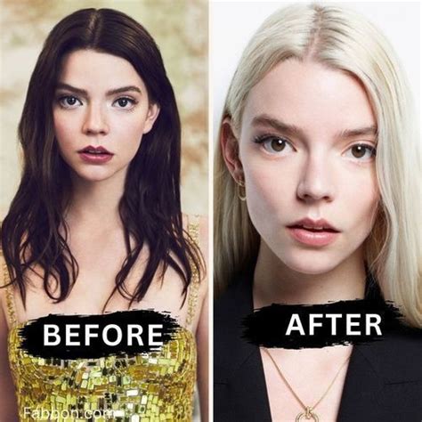 17 Celebrities Who Have Had Buccal Fat Removal 2025 Fabbon