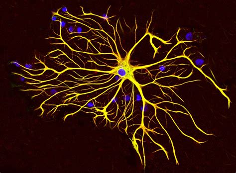 Astrocyte Simple English Wikipedia The Free Encyclopedia