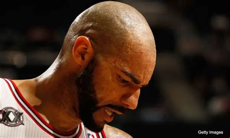 Carlos Boozer Haar Tattoo Basketball Players With Hair Transplants