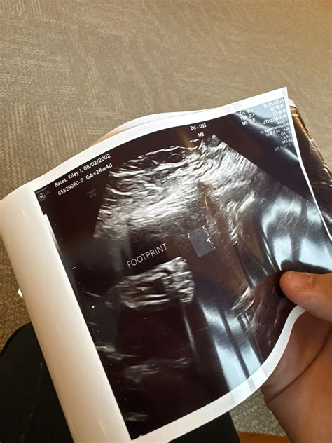 Kiley Lebrun Our Little Bundle Of Joy Is 3 Pound 1 Ounce Facebook