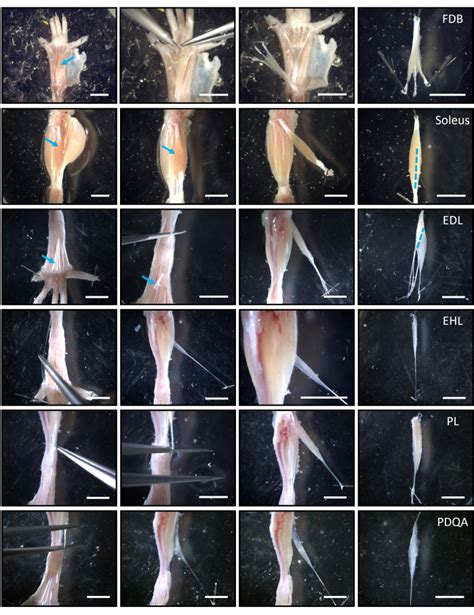 Video Yazar Spot Işığı Lif Tipleri Arasında Uyarma Kasılma Kuplajını İncelemek Için Fare Arka