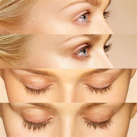 Latisse Eyebrows Before And After Oriuqm