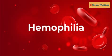 Book Hla Dna Typing High Resolution By Next Generation Sequencing Ngs Test In Chennai Lal