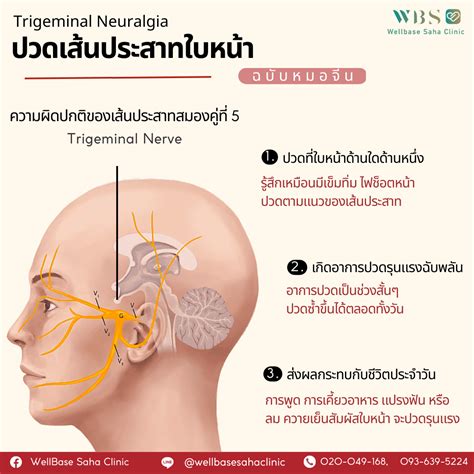 Trigeminal เวลล์เบสสหคลินิกกายภาพบำบัดและแพทย์แผนจีน