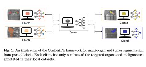 Meet Condistfl A Revolutionary Federated Learning Approach For Organ And Disease Segmentation